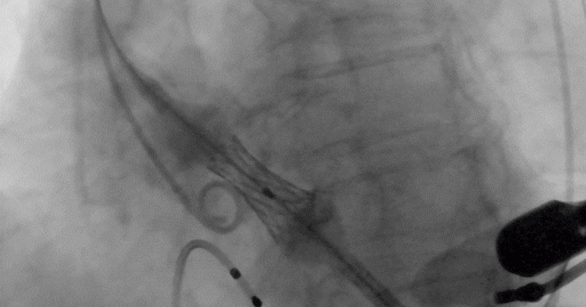 Cineloop - Ziehm Imaging | EN