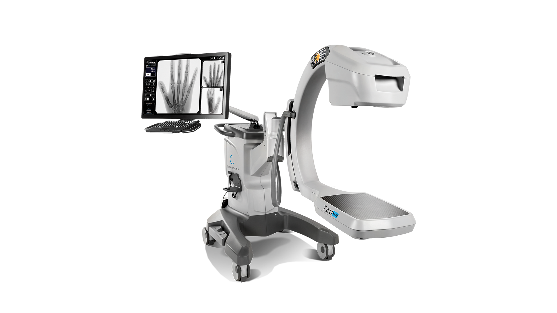 Orthoscan TAU 2020 – El mini arco en C - Ziehm Imaging | ES