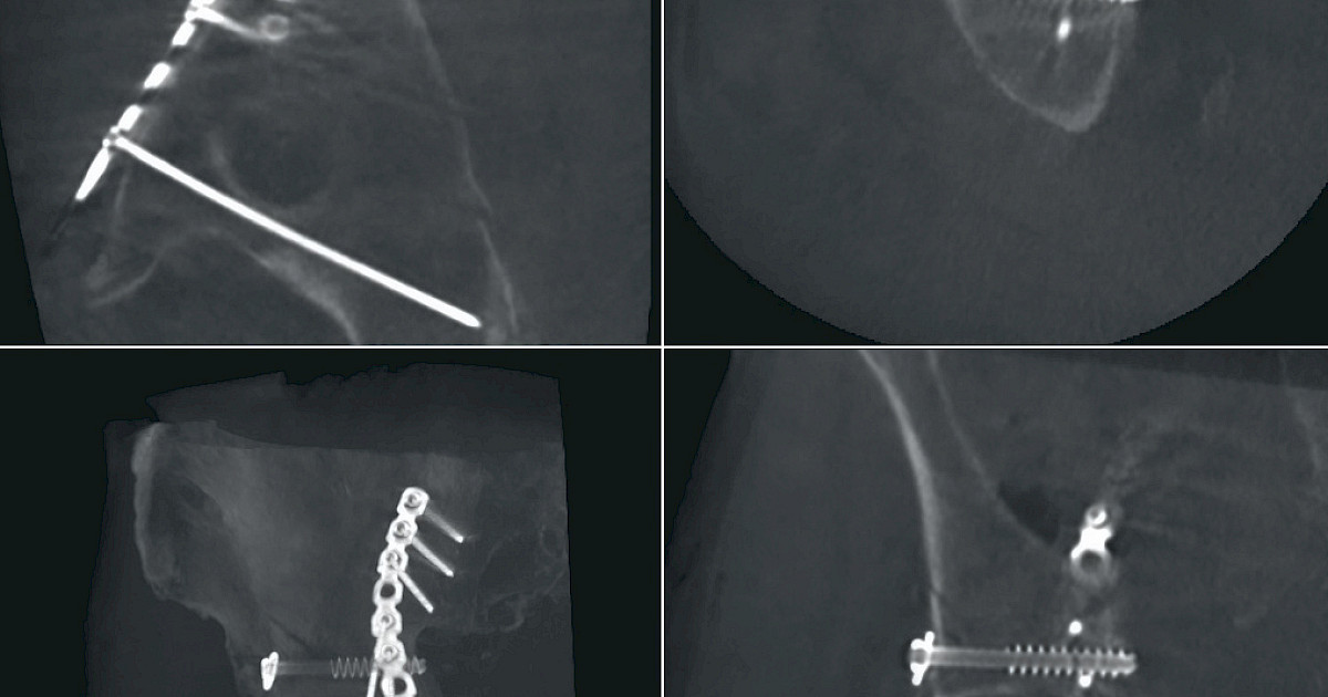 Orthopedics and Traumatology - Ziehm Imaging | EN