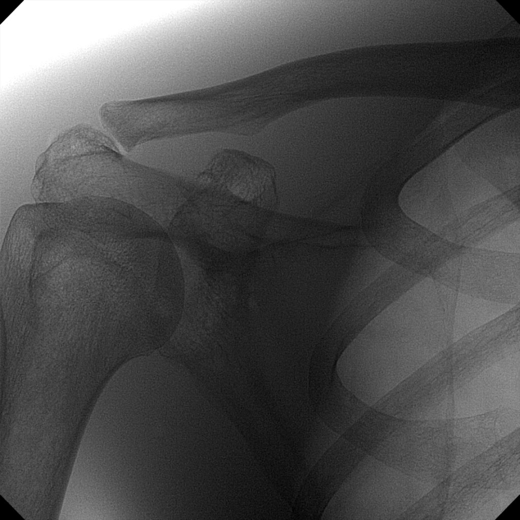 Orthoscan TAU 2020 – El mini arco en C - Ziehm Imaging | ES