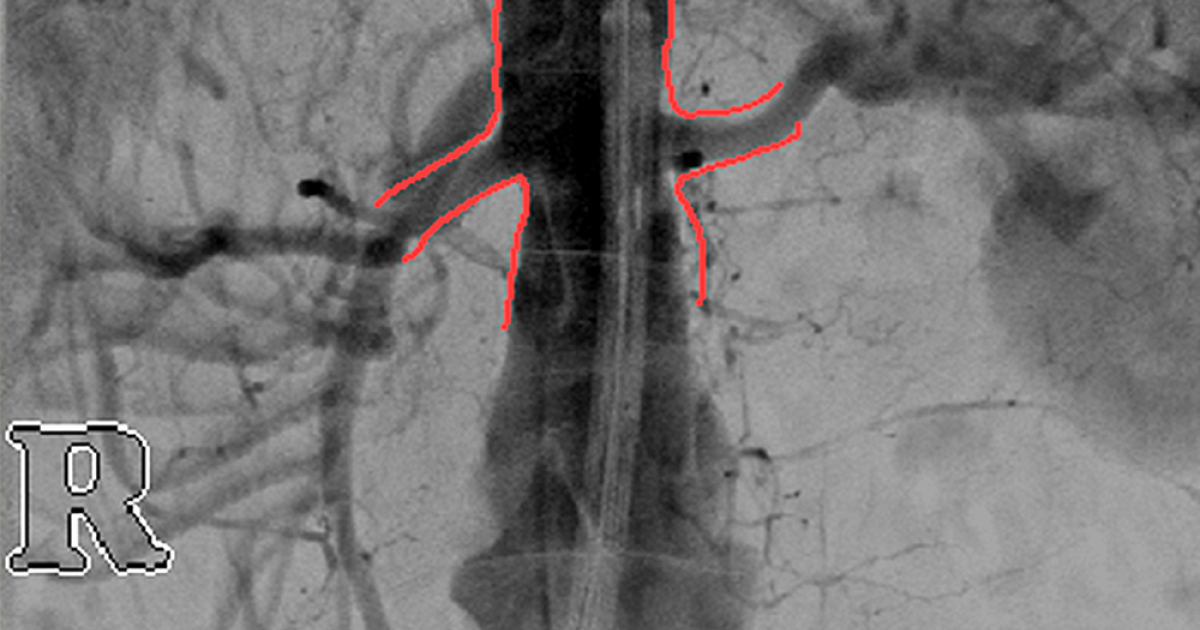 Anatomical Marking Tool (AMT) - Ziehm Imaging | EN