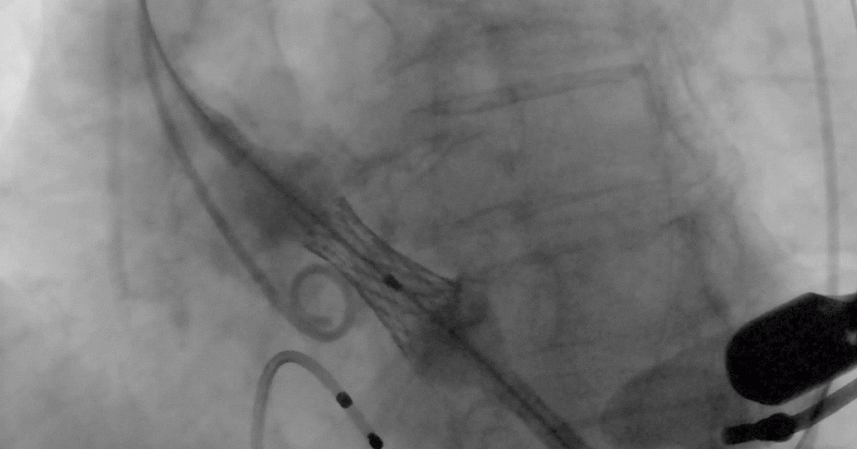 Cine Loop - Ziehm Imaging | EN
