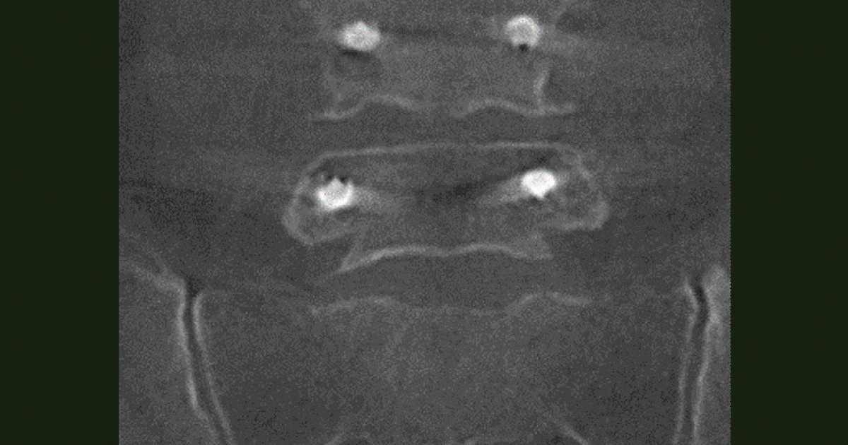 Larger Field of View - Ziehm Imaging | EN